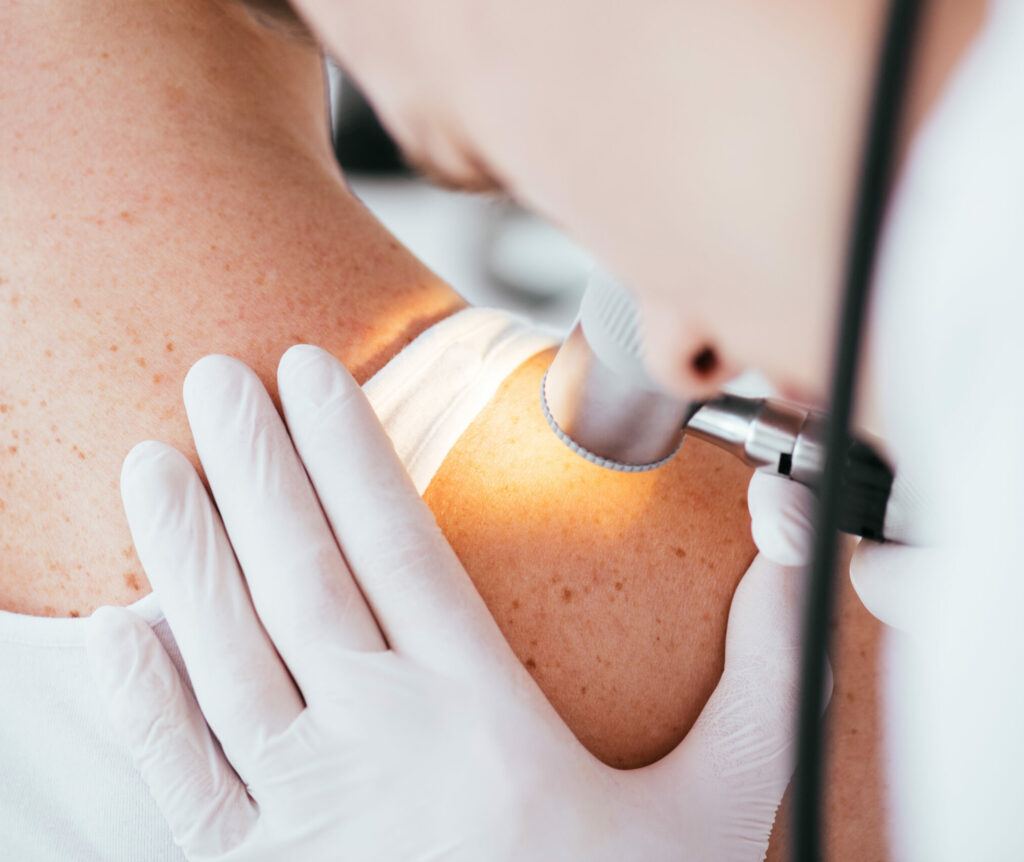 Dermatology | Dermatology | Skin Care | Acne Treatment